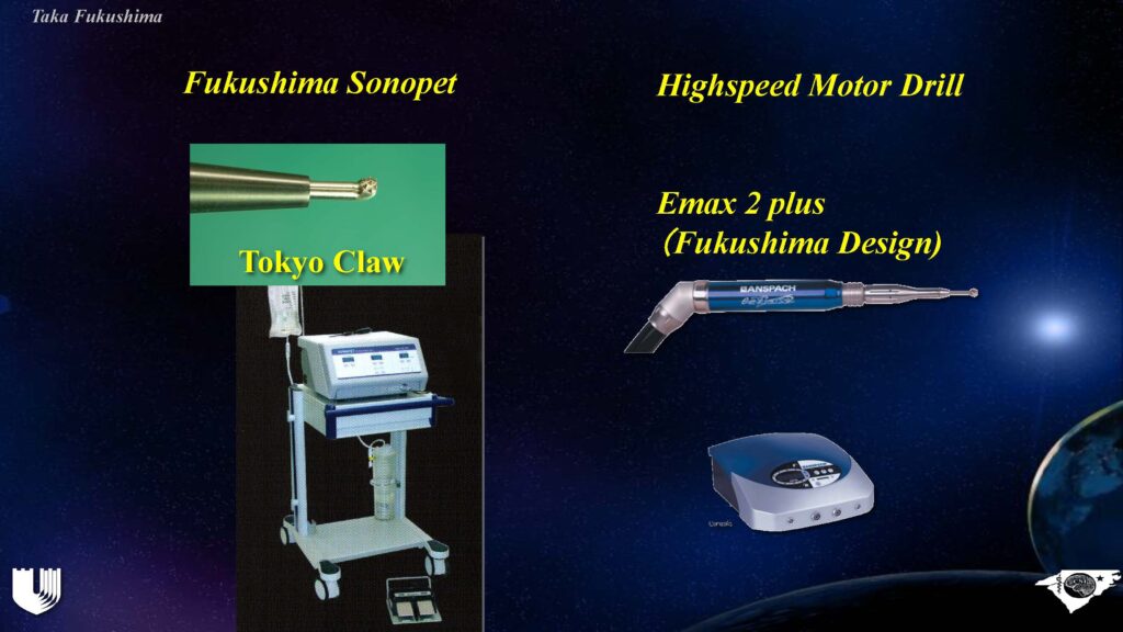 Dr.福島が解説する「聴神経腫瘍（ちょうしんけいしゅよう）」～診断と治療 | 脳神経外科医 福島孝徳 公式サイト